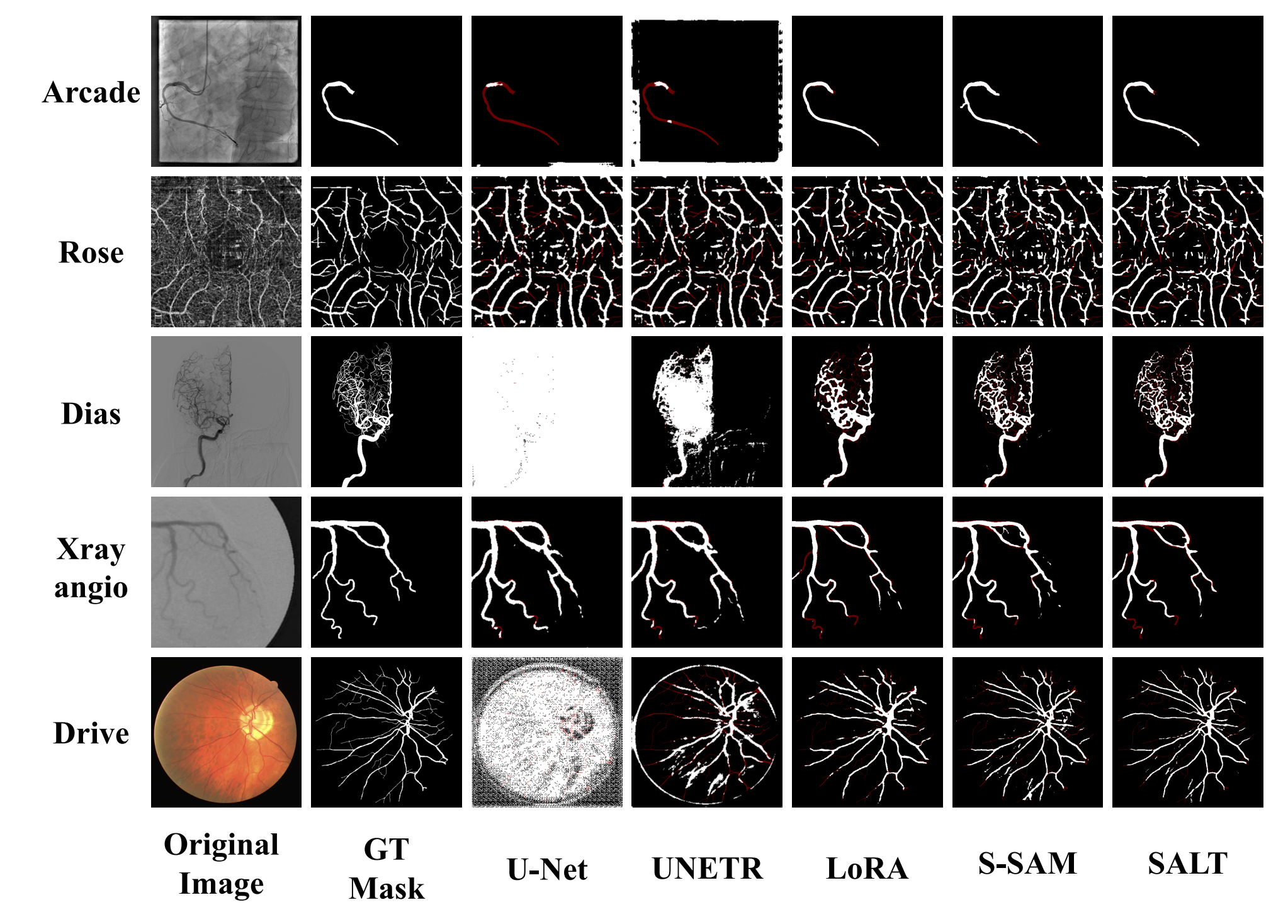 SALT: Parameter-Efficient Fine-Tuning via Singular Value Adaptation with Low-Rank Transformation.